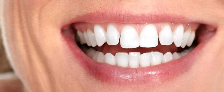 Healthy Teeth Are Happy Teeth 5 Foods That Are Surprisingly Bad For