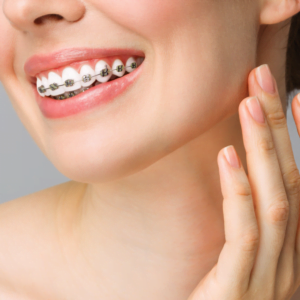 Quick Straight Teeth | AP Smilecare, Blackburn, Lancashire