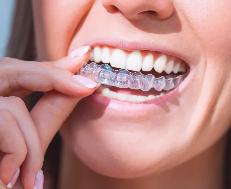 Orthodontic Dentist in Blackburn | Adult Braces | AP Smilecare